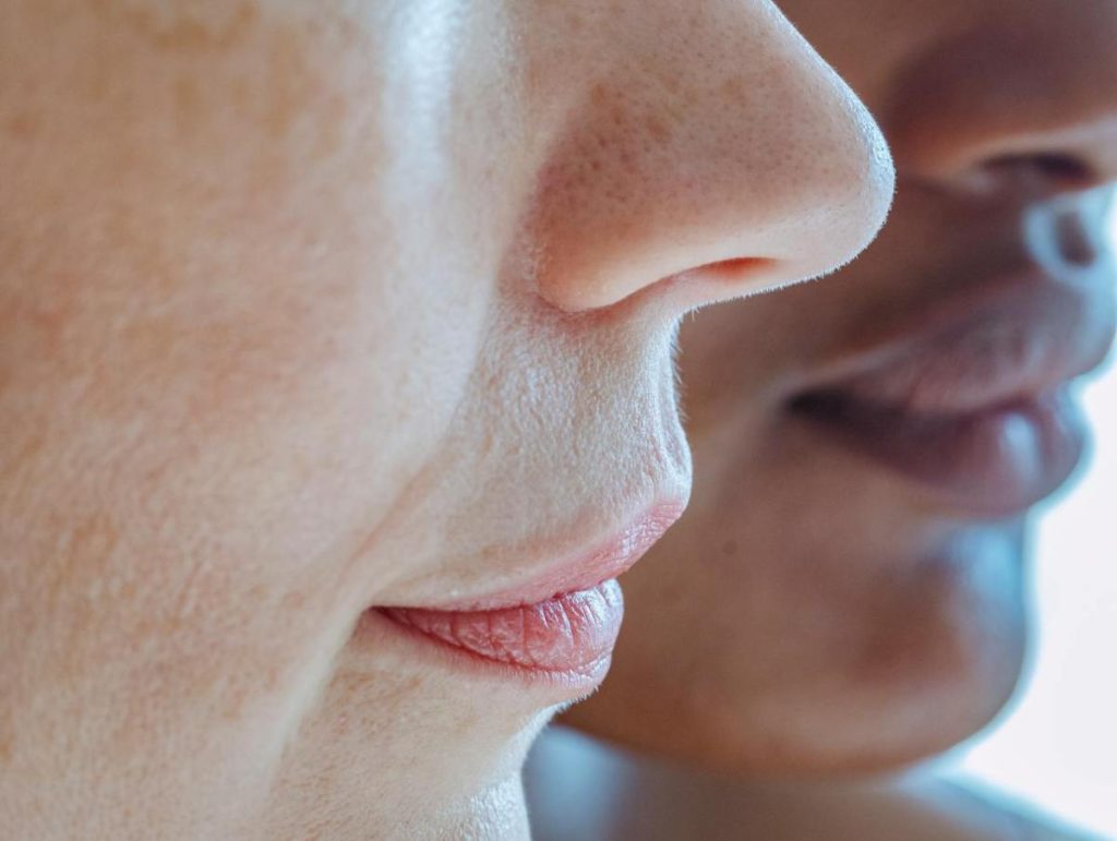 Herpes in der Nase verstehen: Ursachen, Behandlung